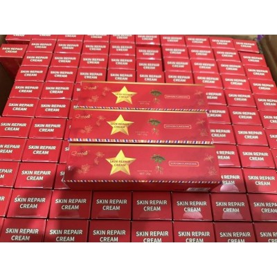 Quesk skin Repair Cream，Queak修复霜~止藓膏,牛皮癣，富贵手，汗斑，湿疹Eczema , anti-moss ...